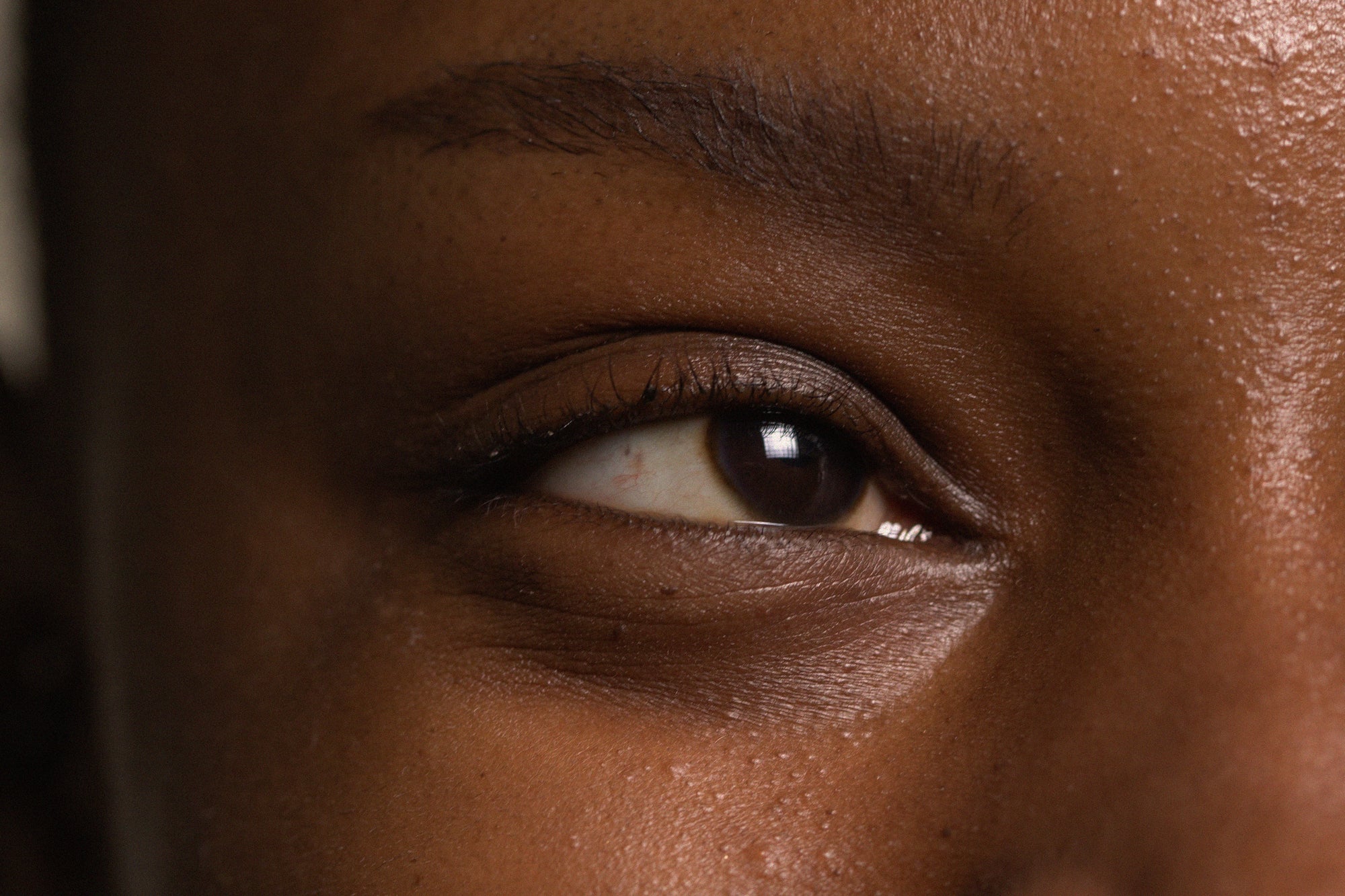 How to Get Rid of Dark Circles: Dermatologist-Approved Guide – Dr Sam's