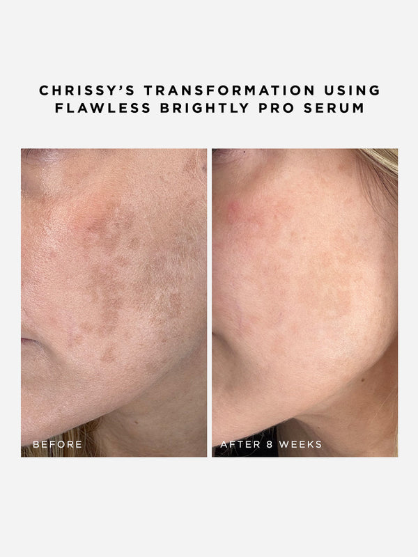 Flawless Brightly Pro Serum – Dr Sam's