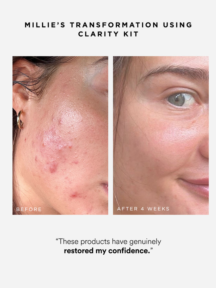 Clarity Kit | Clarifying Skincare Set | Dr Sam's