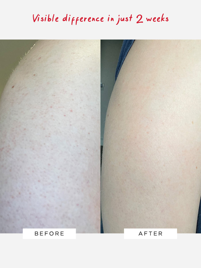 Flawless Body Therapy | Firming Body Moisturiser | Dr Sam's