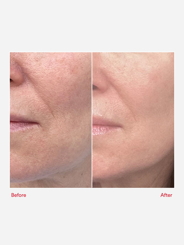 Radiance Kit | Glow-Boosting Skincare Set | Dr Sam's