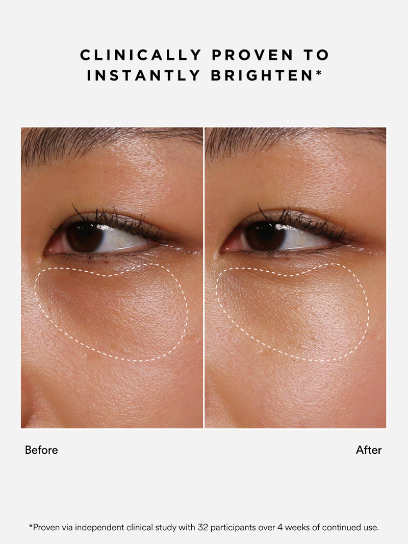 Flawless Brightly Eye Serum | Undereye Serum | Dr Sam's