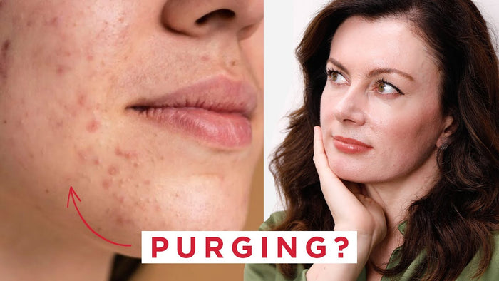 Skin Purging: What It Is & How to Manage It – Dr Sam's